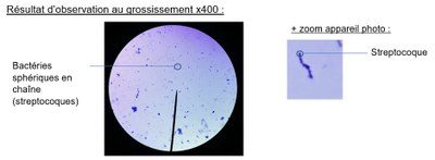 Observer des bactéries au microscope (ferments lactiques) — Site des ressources d'ACCES pour ...
